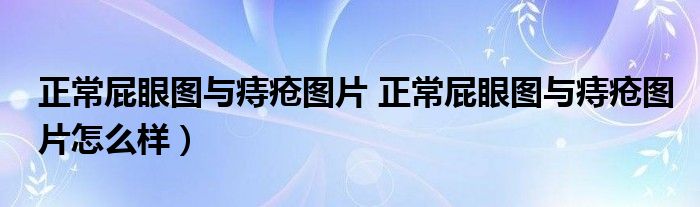 正常屁眼图与痔疮图片 正常屁眼图与痔疮图片怎么样)草根科学网